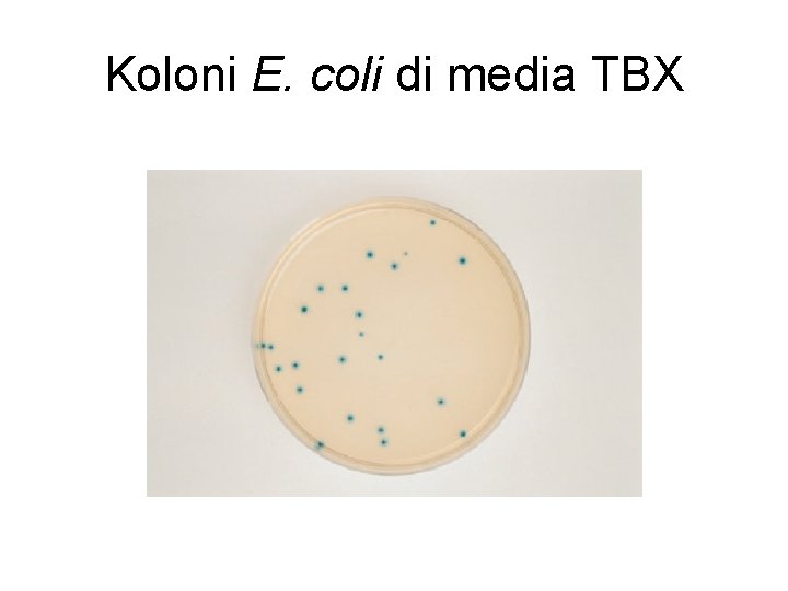 PEMERIKSAAN ANGKA KUMAN Zainab M Si Apt TUJUAN