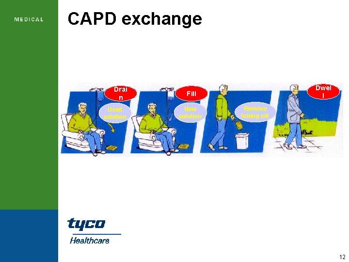 Dialysis Access 1 Vascular System Superior Vena Cava