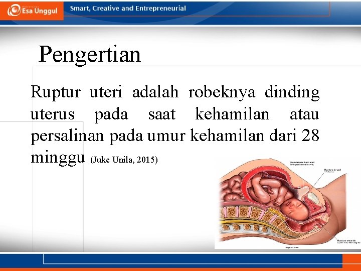 ASKEP Ruptur Uteri dan ASKEP Plasenta Previa Pertemuan