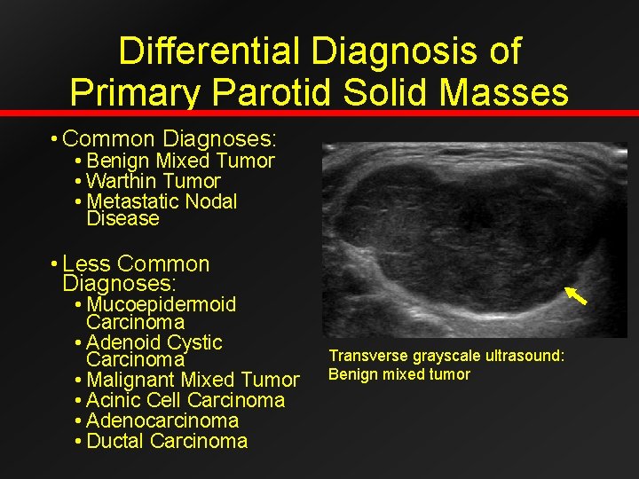 Multimodality Imaging Overview of Common and Uncommon Solid