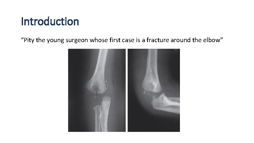Elbow Injuries DR R B Kalia Additional Professor