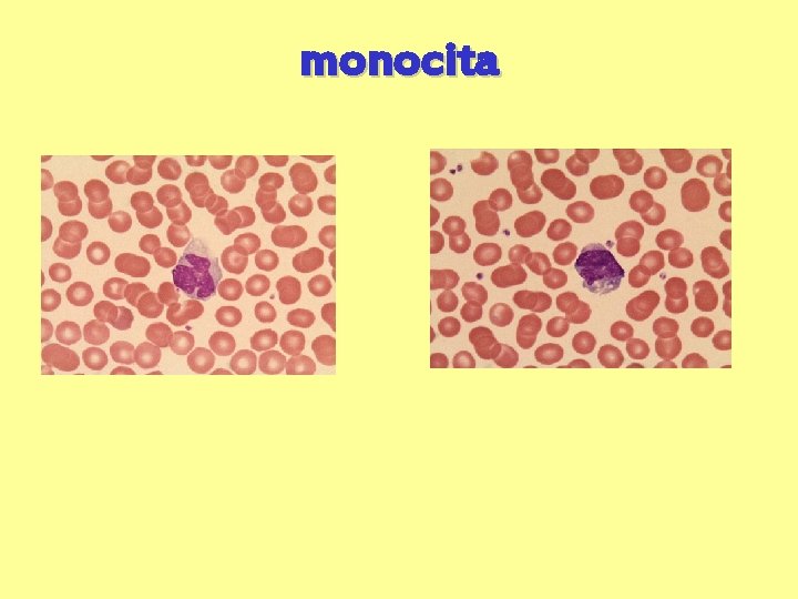 Diagnostiche Molecolari Integrate Modulo di Ematologia Docente Prof