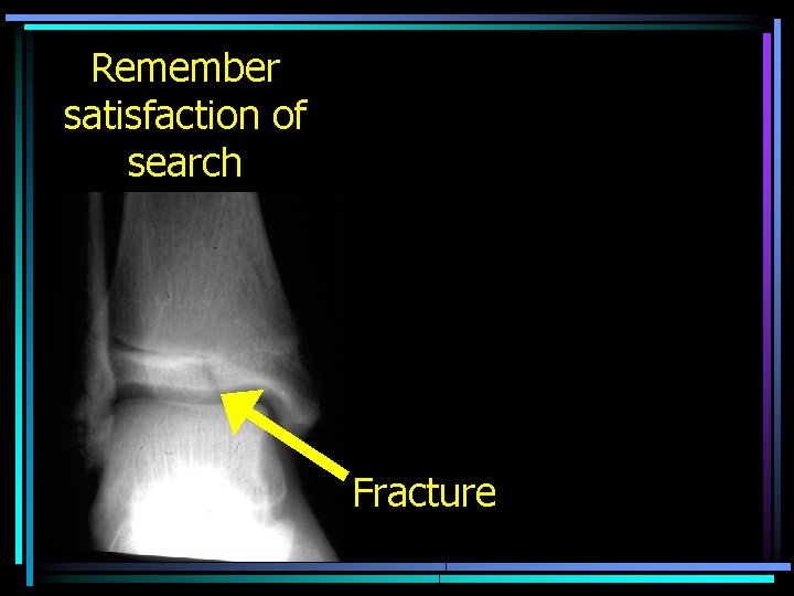 HOW TO APPROACH THE RADIOGRAPHIC DIAGNOSIS OF FRACTURES