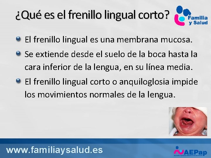 Frenillo lingual corto y lactancia materna M Rosario