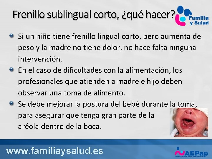 Frenillo lingual corto y lactancia materna M Rosario