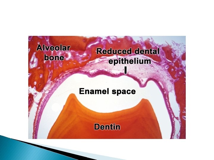amelogenesis Life cycle of the ameloblasts According to