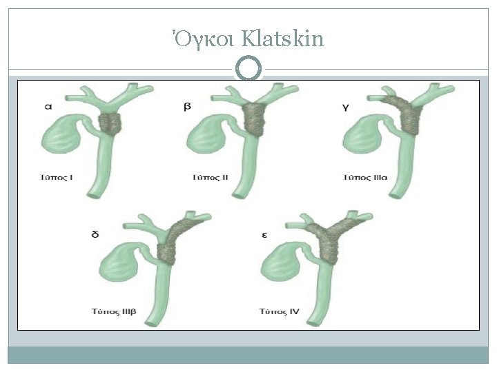 Biliary Tract Intra hepatic ducts Exta hepatic ducts