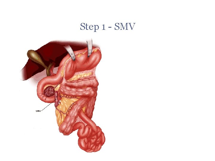 Biliary Tract Intra hepatic ducts Exta hepatic ducts