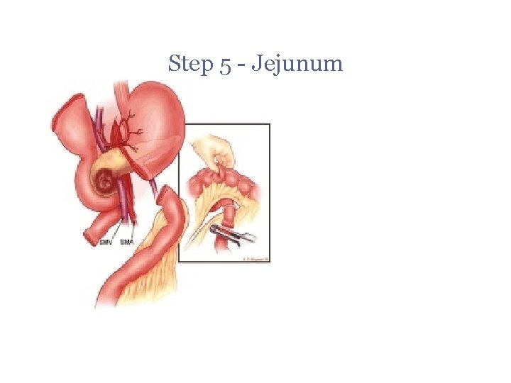 Biliary Tract Intra hepatic ducts Exta hepatic ducts