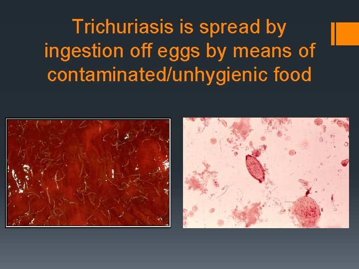 Trichuriasis aka Whipworm Infection Brian Ta Life Cycle