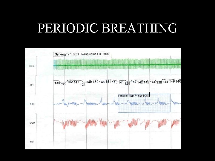 APNEA OBJECTIVES Understand the control and maturation of