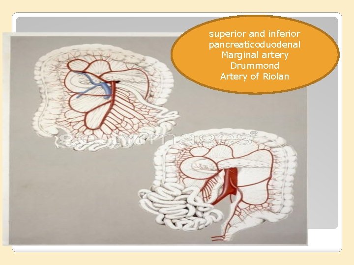 Celiac Artery Mesenteric Vessels Injuries Martha A Quiodettis