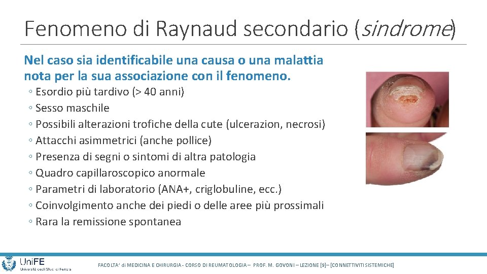 Le connettiviti sistemiche PROF MARCELLO GOVONI MARCELLO GOVONIUNIFE