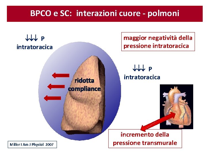 Broncopneumopatia cronica ostruttiva e comorbidit cardiovascolari ...