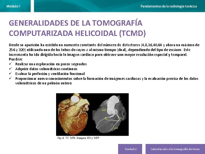 INTRODUCCIN A LA TOMOGRAFA DE TRAX Dra Marina