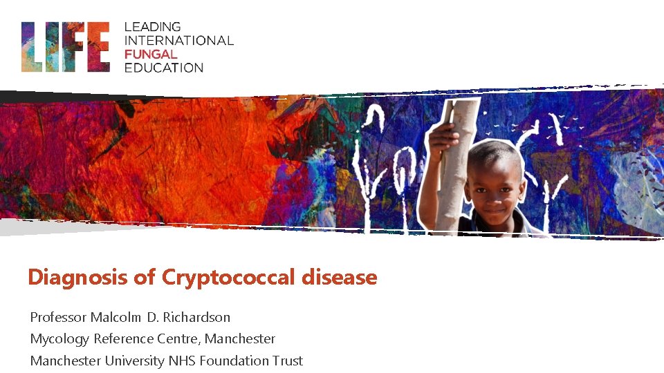 Diagnosis of Cryptococcal disease Professor Malcolm D Richardson