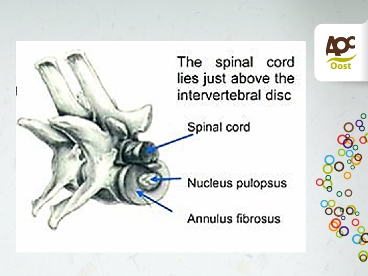 Rug aandoeningen Inhoud Anatomie wervelkolom Wobbler syndroom Hernia