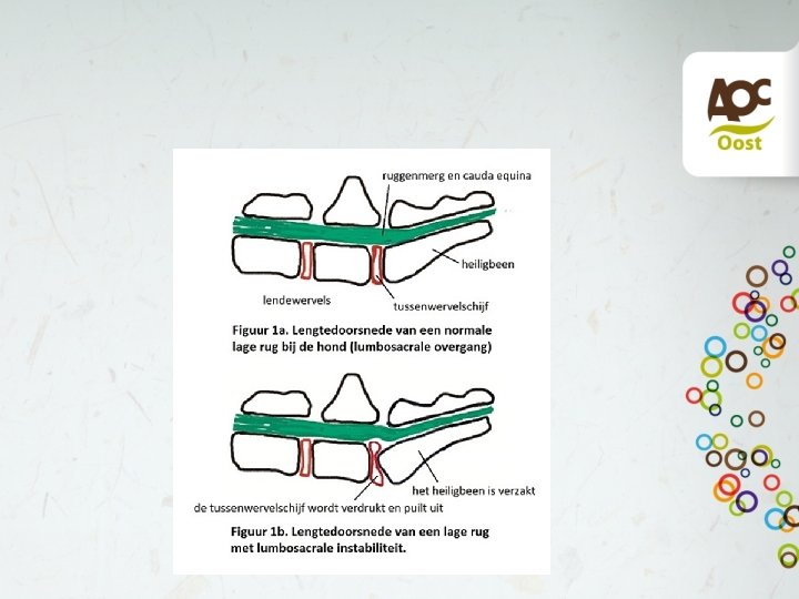 Rug aandoeningen Inhoud Anatomie wervelkolom Wobbler syndroom Hernia