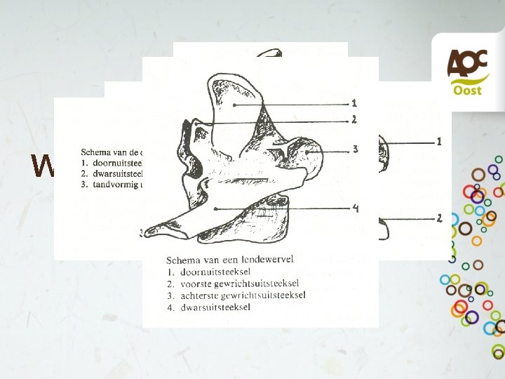 Rug aandoeningen Inhoud Anatomie wervelkolom Wobbler syndroom Hernia