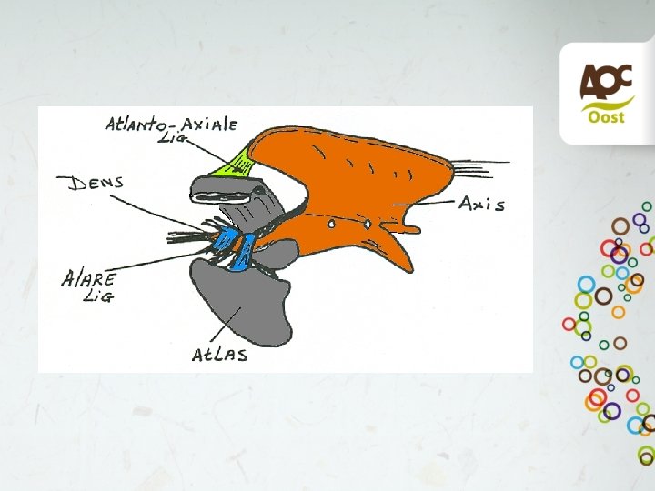 Rug aandoeningen Inhoud Anatomie wervelkolom Wobbler syndroom Hernia