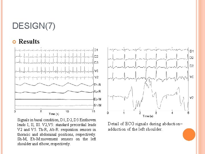 ECG SIGNAL ACQUISITION HARDWARE DESIGN University of Alabama