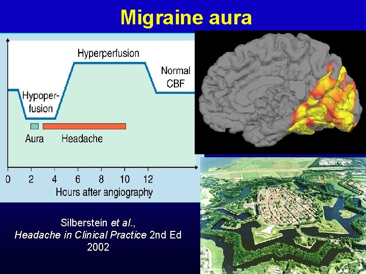 Migraine Pathophysiology An Update BASH Teaching Meeting Hull
