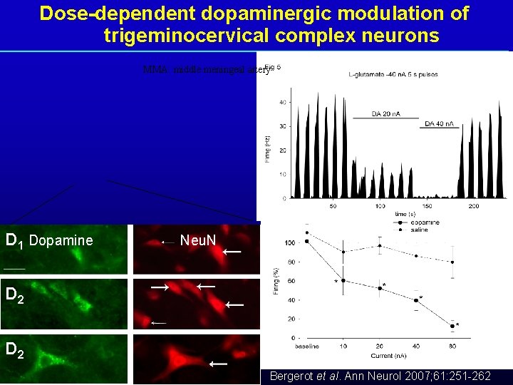 Migraine Pathophysiology An Update BASH Teaching Meeting Hull