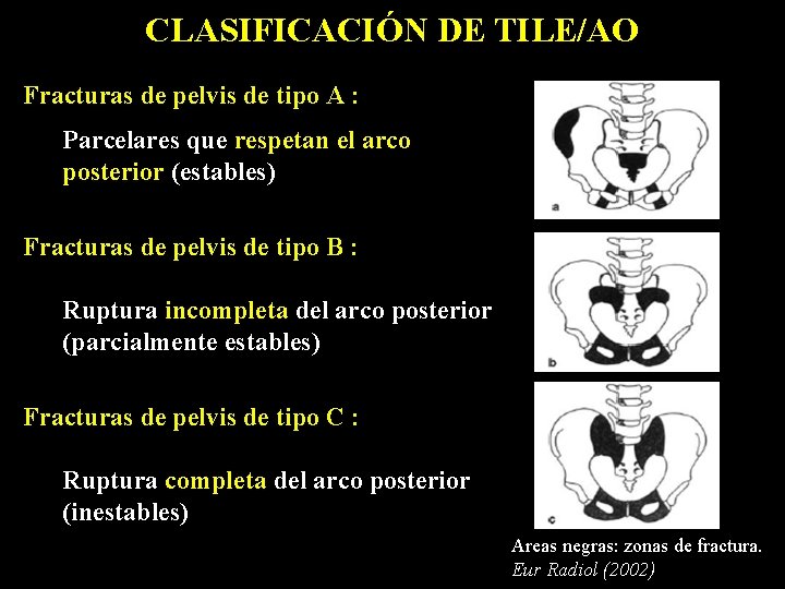 Sistemas de clasificacin Ayudan a predecir la inestabilidad