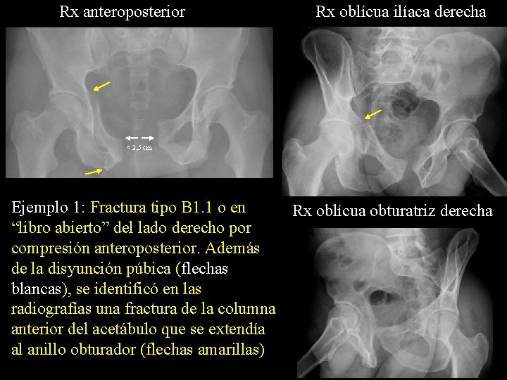 Sistemas de clasificacin Ayudan a predecir la inestabilidad