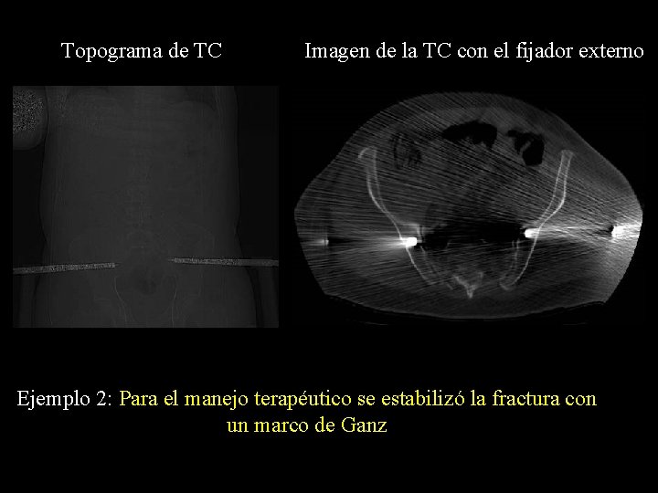 Sistemas de clasificacin Ayudan a predecir la inestabilidad