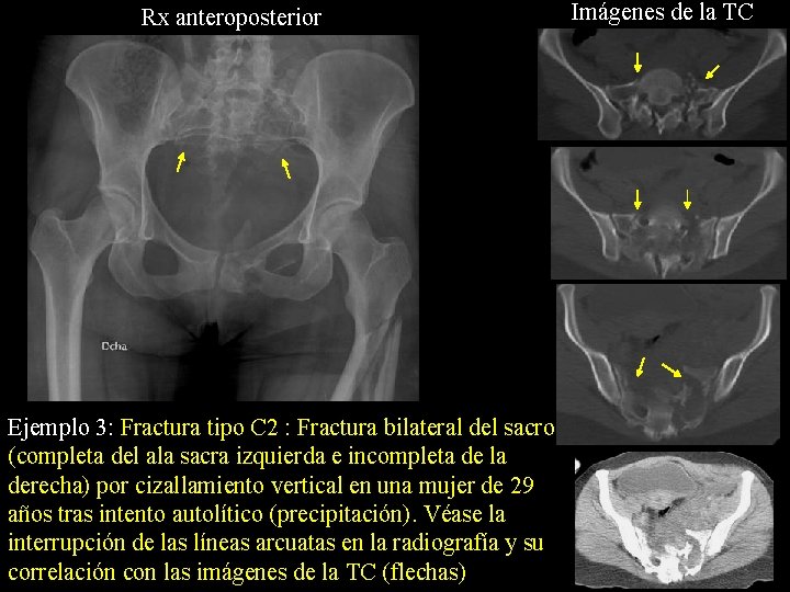 Sistemas De Clasificacin Ayudan A Predecir La Inestabilidad