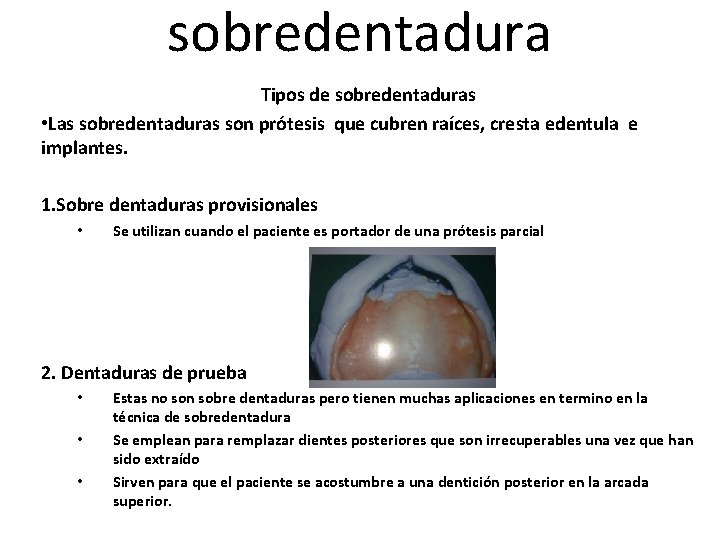 sobredentadura Races de rganos dentarios como pilares en