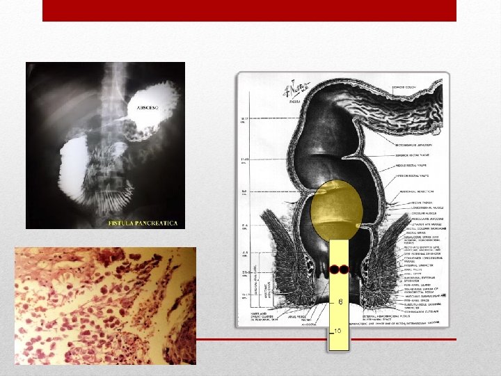 Enfermedades anorrectales Anatoma Limites recto y ano Recto