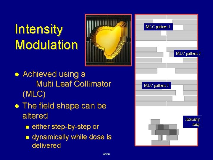 Radiotherapy Treatment Planning Treatment planning is the task