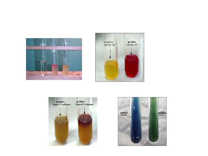 E coli Prof Jyotsna Agarwal Dept Microbiology KGMU