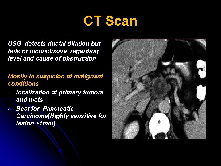 Imaging in Surgical Obstructive Jaundice Dr Himadri Sikhor