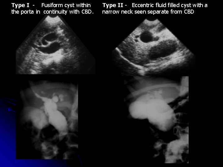 Imaging in Surgical Obstructive Jaundice Dr Himadri Sikhor