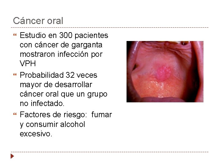 Virus del Papiloma Humano M Paz MICROBIOLOGA II