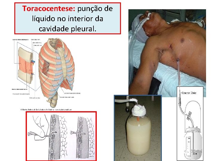 ANATOMIA SISTMICA Sistema Respiratrio Prof Dr Lus Fernando