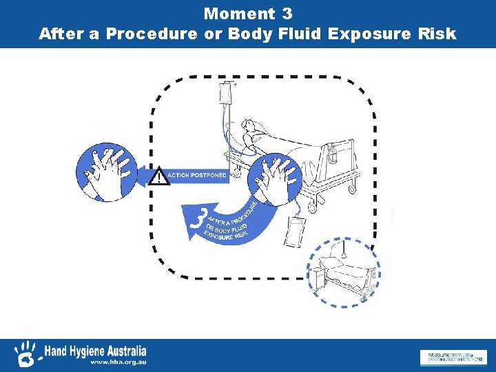 5 Moments for Hand Hygiene Based on the