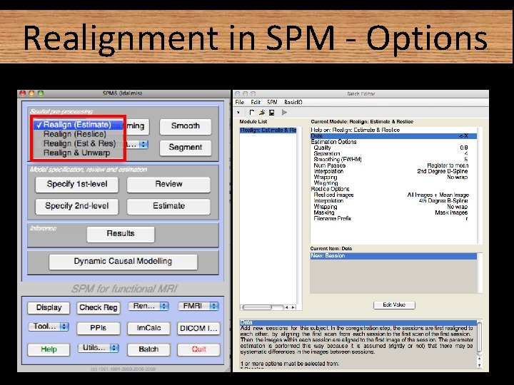 Methods for Dummies Preprocessing Realigning and Unwarping Rashmi