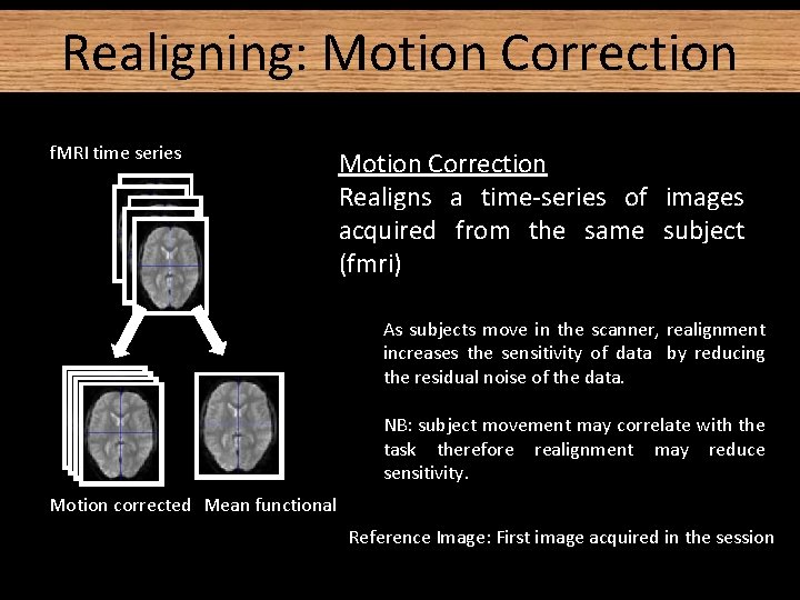 Methods for Dummies Preprocessing Realigning and Unwarping Rashmi