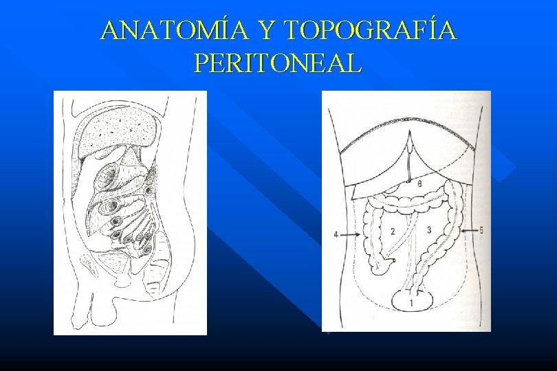 FISIOPATOLOGIA PERITONEAL PERITONITIS Trmino genrico que describe la