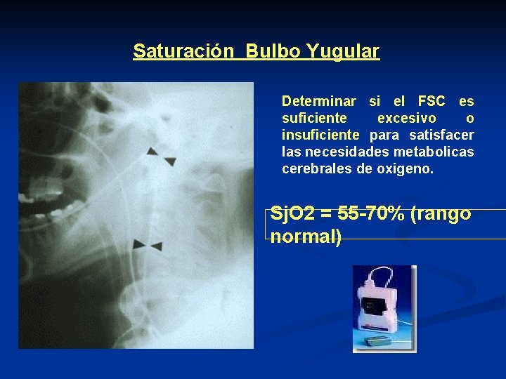 Ventilacin Mecnica en el Paciente Neuroquirurgico Modos y