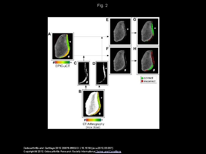 CT arthrography of the human knee to measure