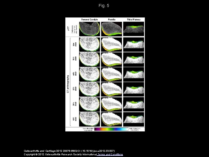 CT arthrography of the human knee to measure