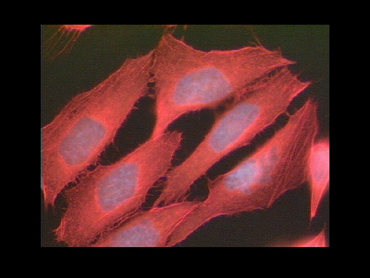 nucleus Nucleus blue and Microtubules green Nucleus and