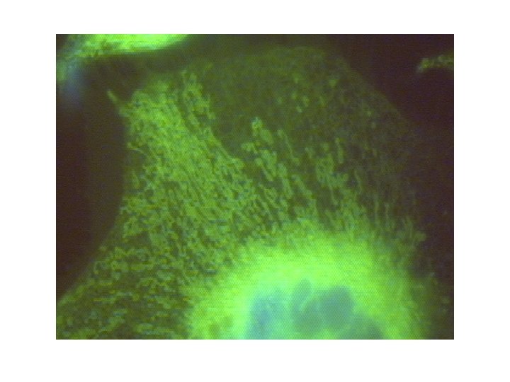 nucleus Nucleus blue and Microtubules green Nucleus and