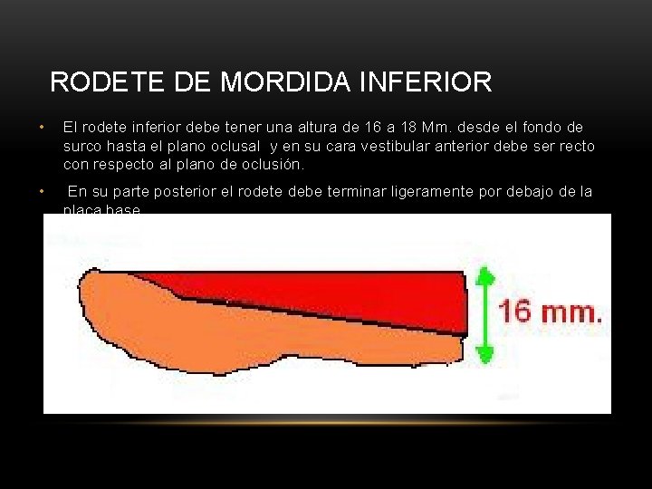 RODETES Andrea Ramrez Paola Snchez DIMENSION VERTICAL Relacin