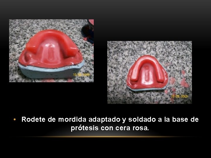 RODETES Andrea Ramrez Paola Snchez DIMENSION VERTICAL Relacin